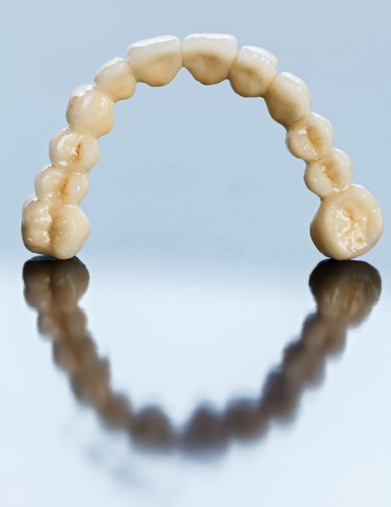 - Fixed Bridge Philippines - Smile More Dental-Manila