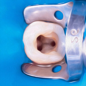 Philippines Root Canal Price: Essential Tips and Costs